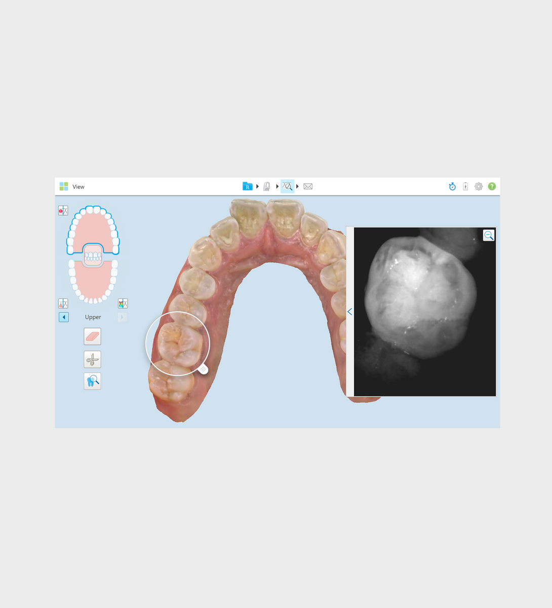 Itero™ Niri Technology Near Infra Red Imaging Upgrade Kit Itero Store
